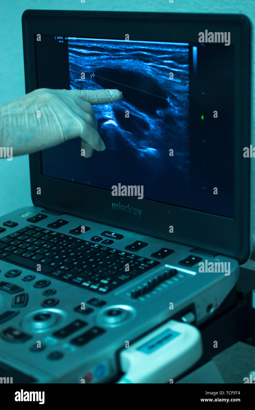 Epi percutaneous intratissue electrolysis scan hi-res stock photography and images - Alamy