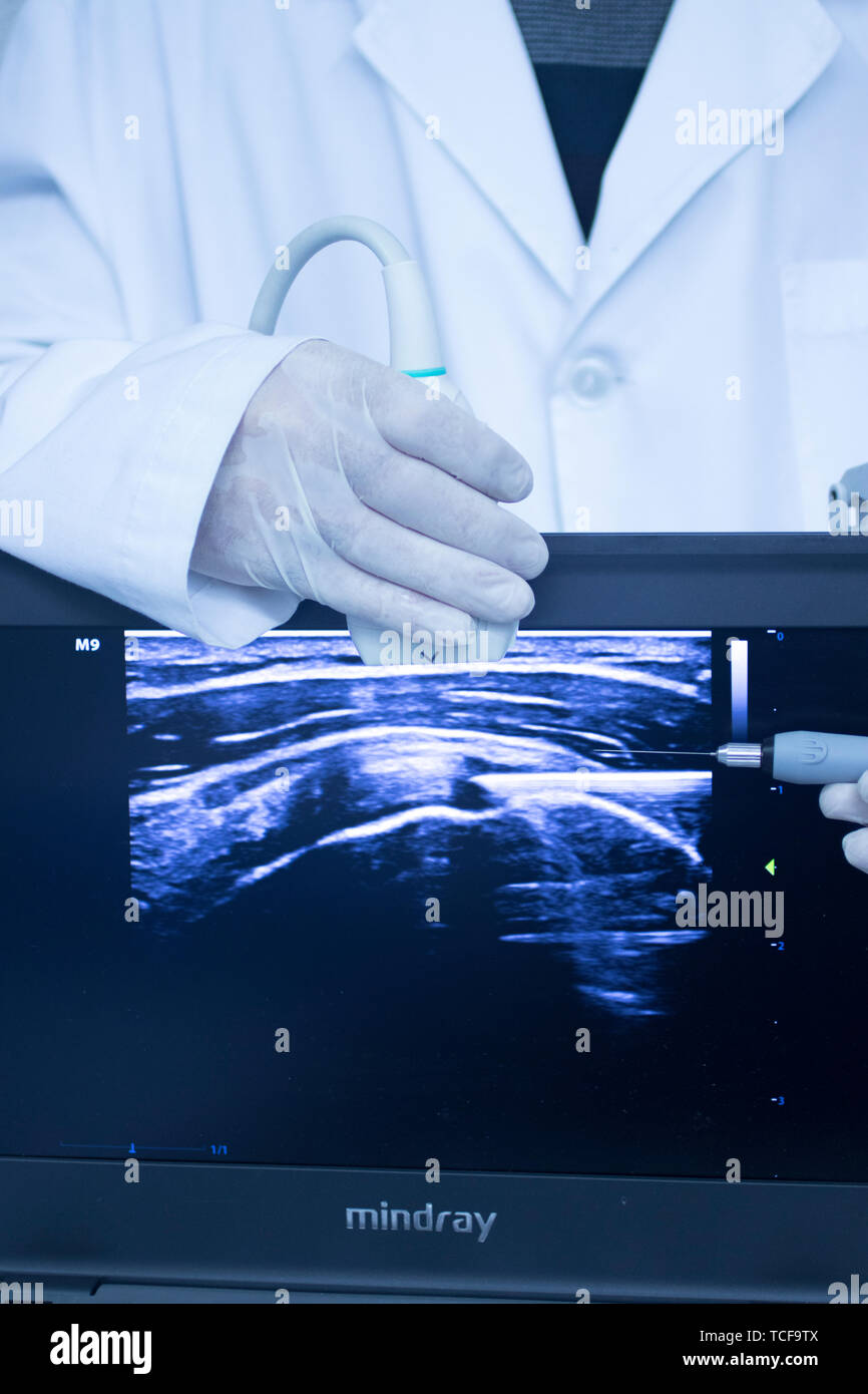 Epi percutaneous intratissue electrolysis scan hi-res stock photography and images - Alamy