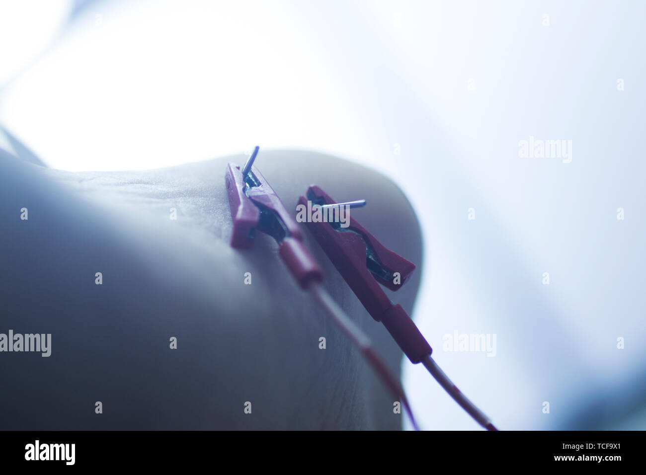 Percutaneous electrolysis hi-res stock photography and images - Alamy