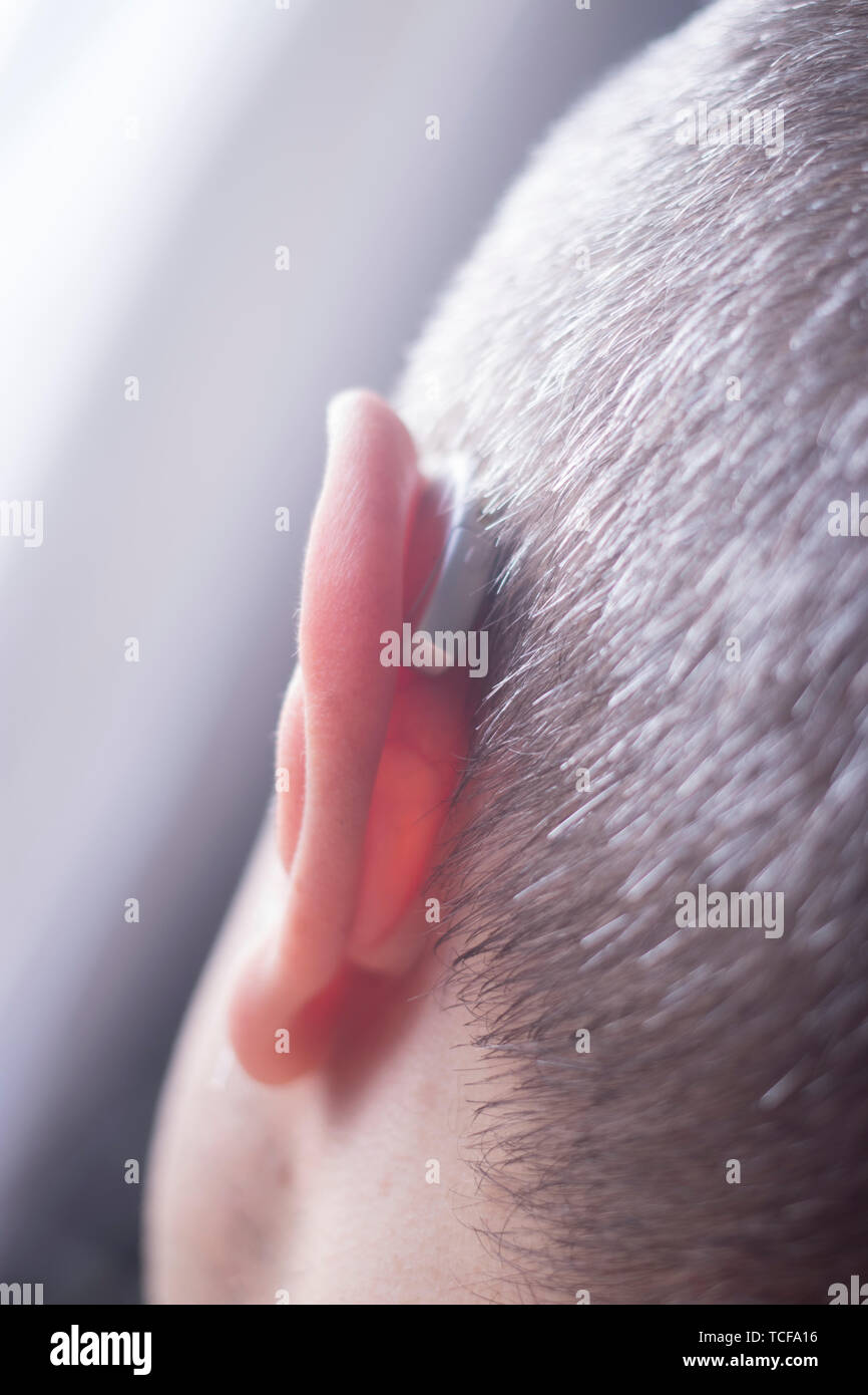 Digital modern technology for deaf people micro hearing aid Stock Photo ...