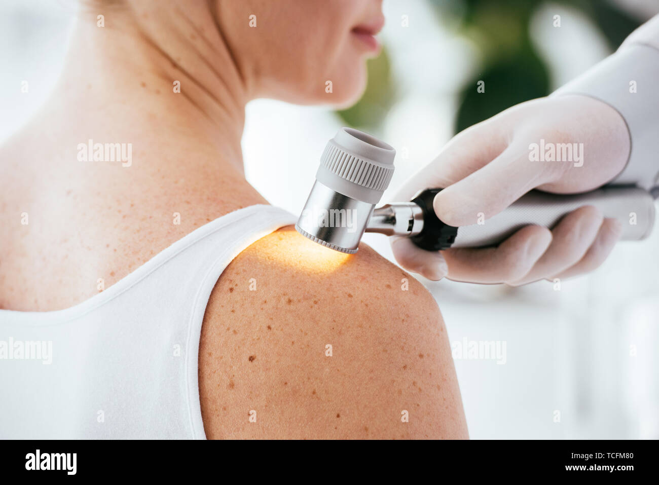 cropped view of dermatologist holding dermatoscope while examining ...