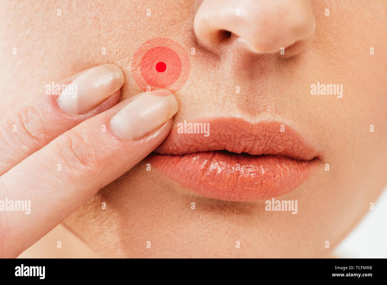 cropped view of woman touching face with acne Stock Photo - Alamy