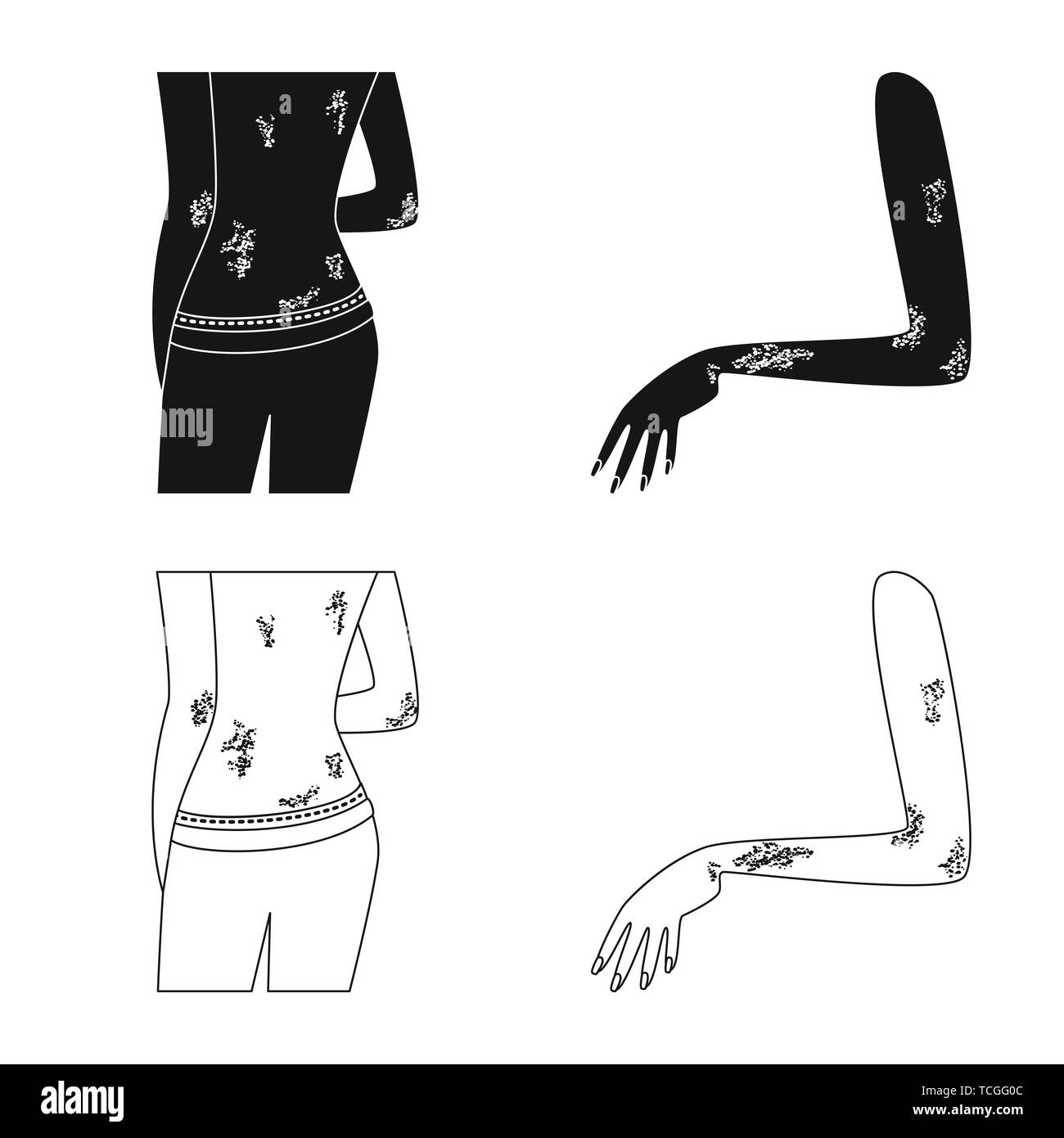 Eczema Black and White Stock Photos & Images - Alamy