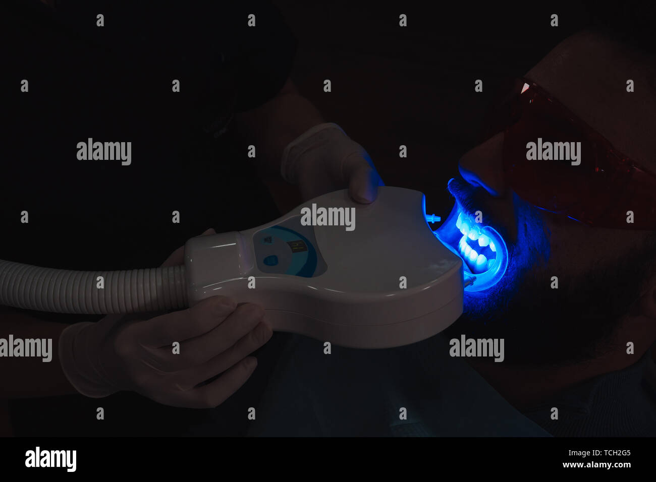 Laser bleaching teeth at dentist room. Teeth whitening for men ...