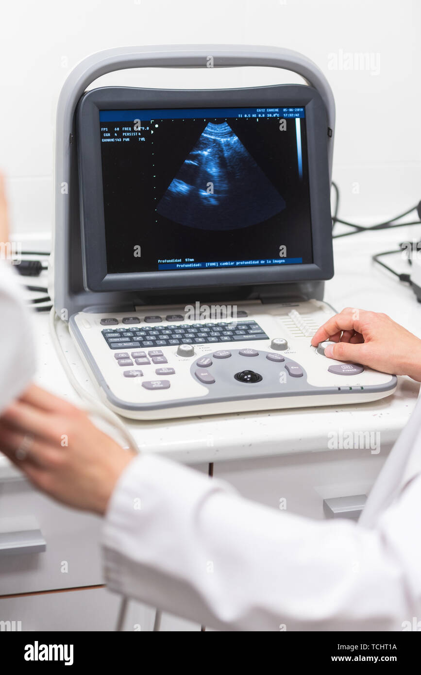 Ultrasound scanner in the hands of a doctor. Diagnostical Sonography ...