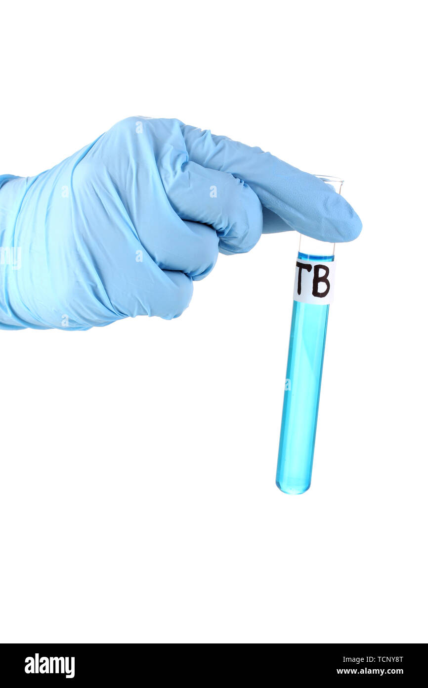 Test tube labeled Tuberculosis(TB) isolated on white Stock Photo - Alamy