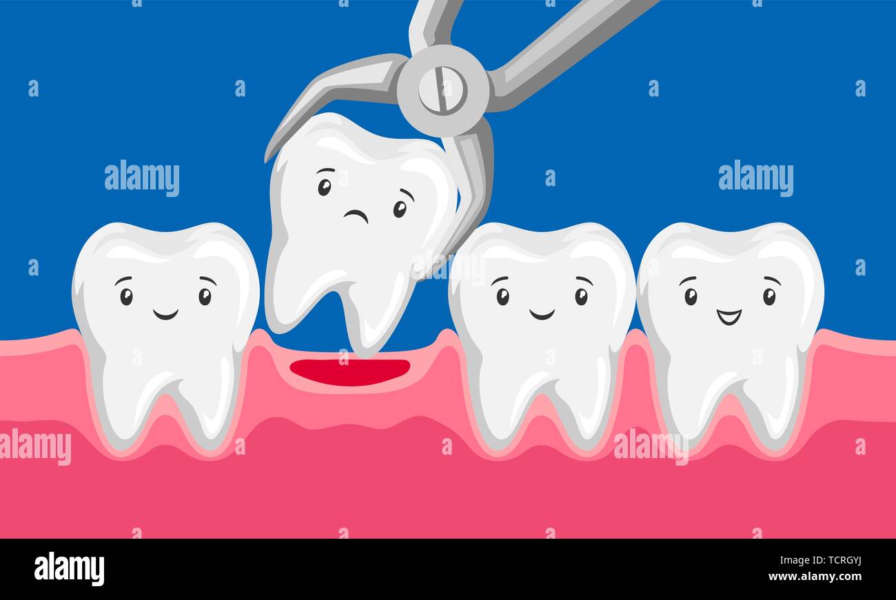 Teeth forceps Stock Vector Images - Alamy