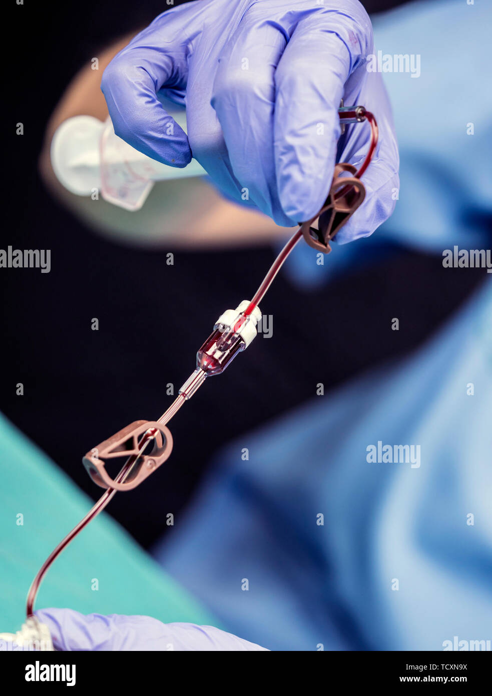 Indwelling Venous Catheter