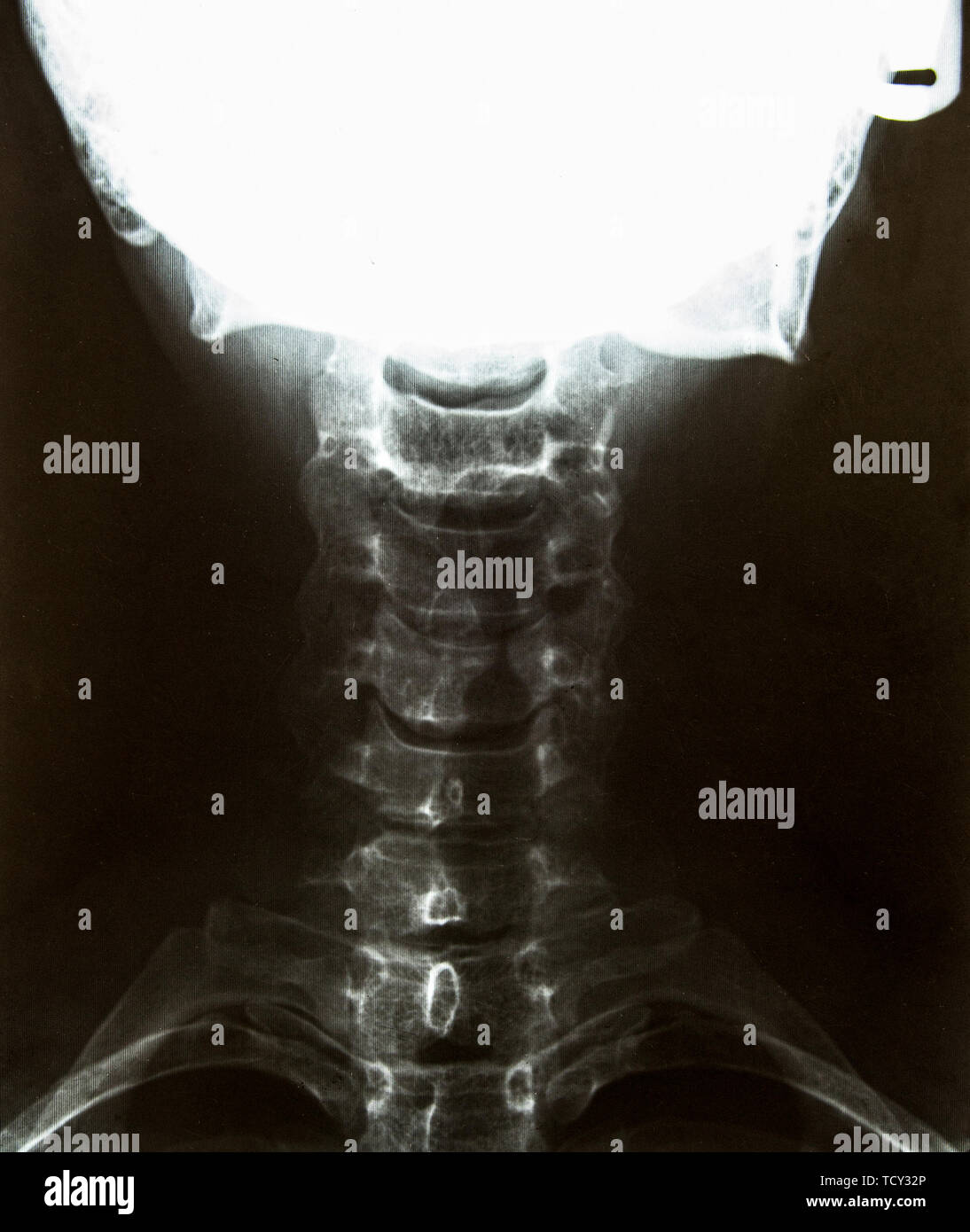 Skull neck hi-res stock photography and images - Alamy