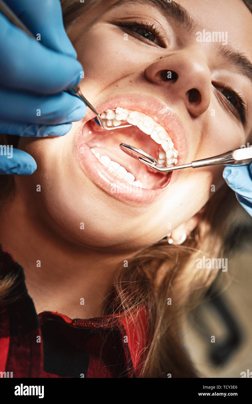 Close-up of girl opening her mouth wide during inspection of oral ...