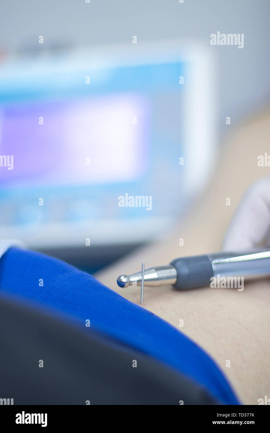 Intratissue percutaneous electrolysis hi-res stock photography and images - Alamy