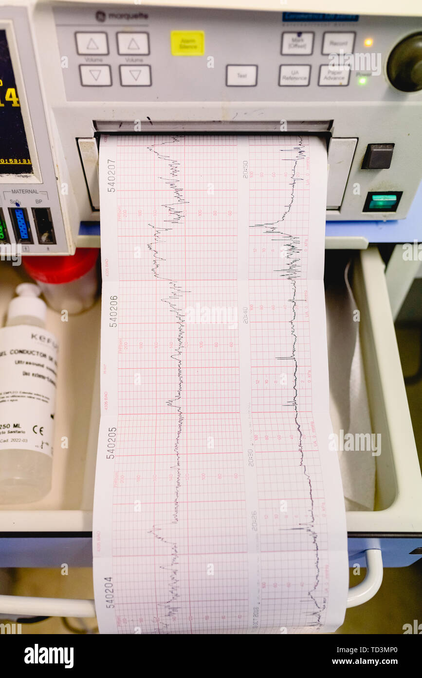 Ecg of a woman hi-res stock photography and images - Alamy