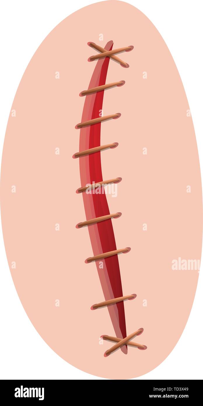 Suture icon. Cartoon of suture vector icon for web design isolated on white background Stock ...
