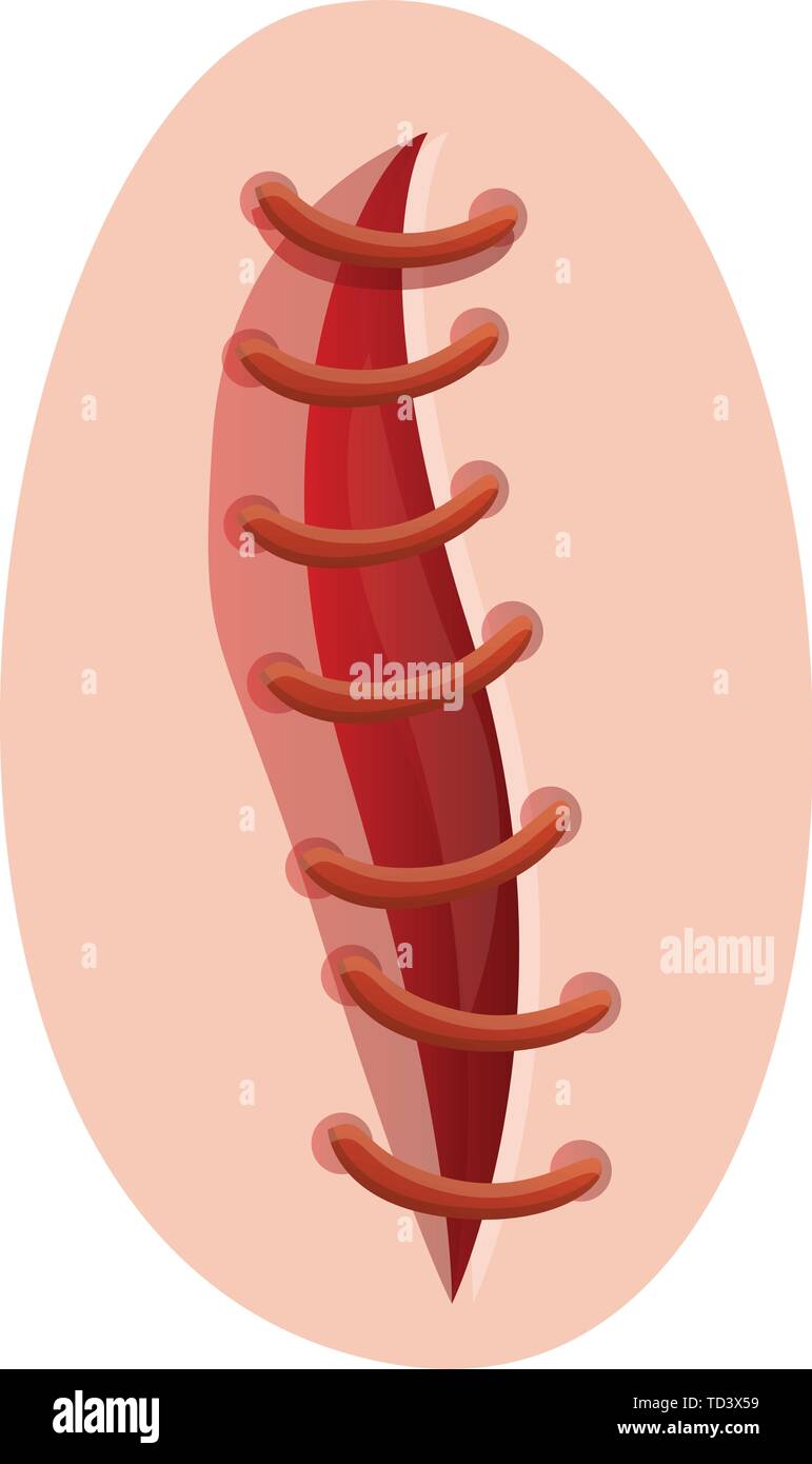 Open suture icon. Cartoon of open suture vector icon for web design ...
