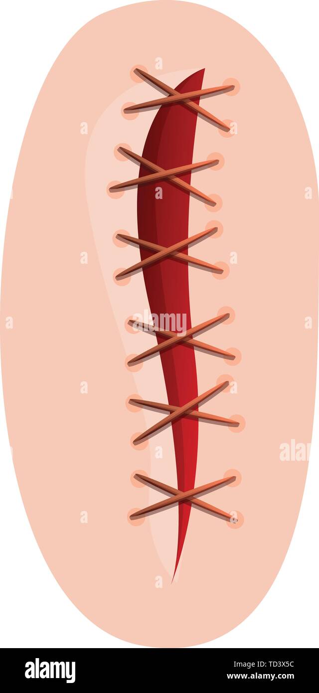 Wound healing process Stock Vector Images - Alamy