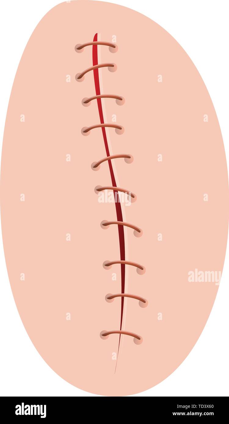 Surgical suture icon. Cartoon of surgical suture vector icon for web ...