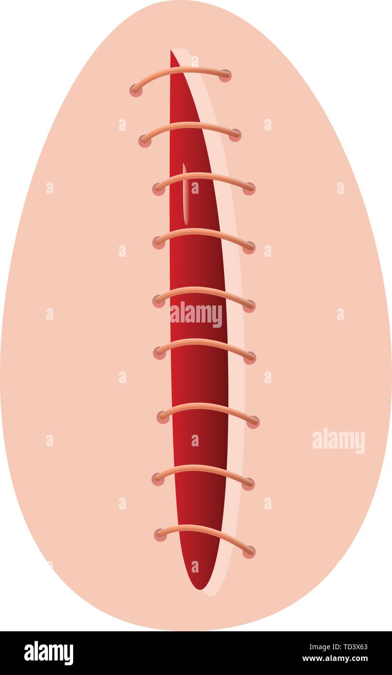 Doctor suture icon. Cartoon of doctor suture vector icon for web design ...