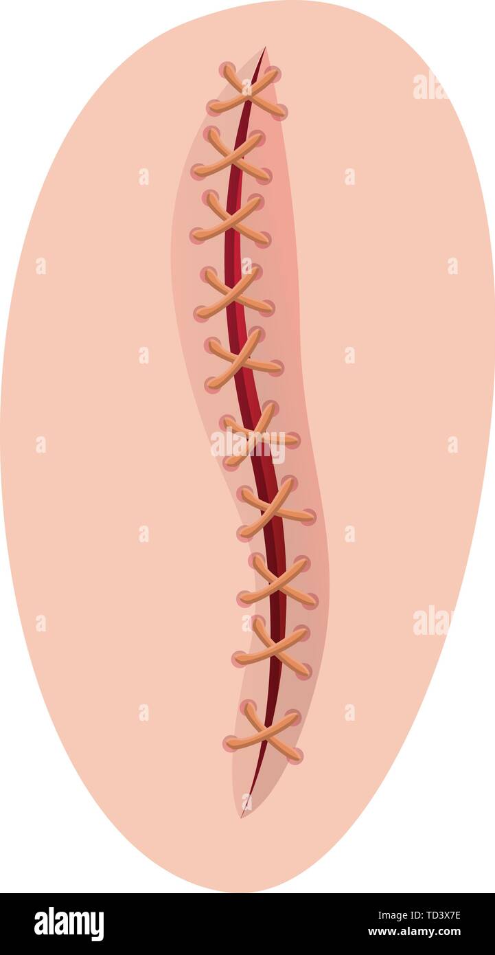Incision suture icon. Cartoon of incision suture vector icon for web ...