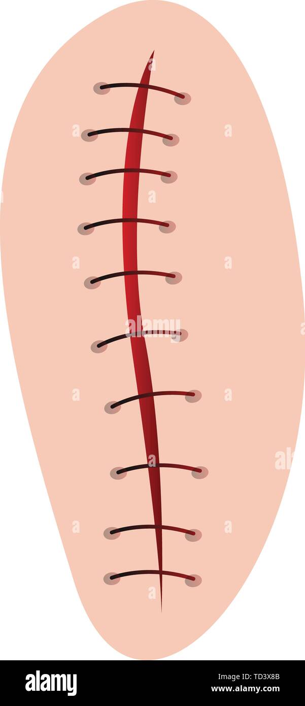 Skin suture icon. Cartoon of skin suture vector icon for web design ...