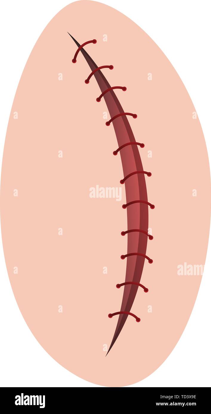 Operation suture icon. Cartoon of operation suture vector icon for web ...