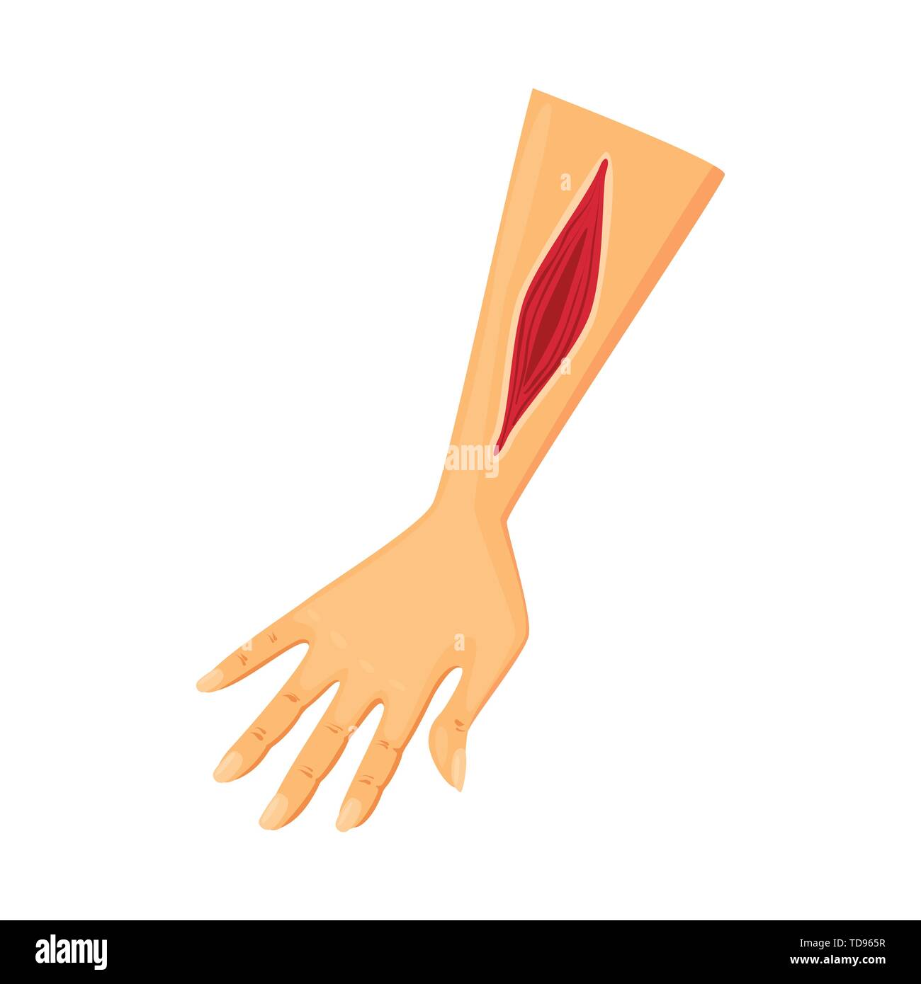 body,hand,treatment,anatomy,wound,human,injury,arm,skin,blood,medical ...