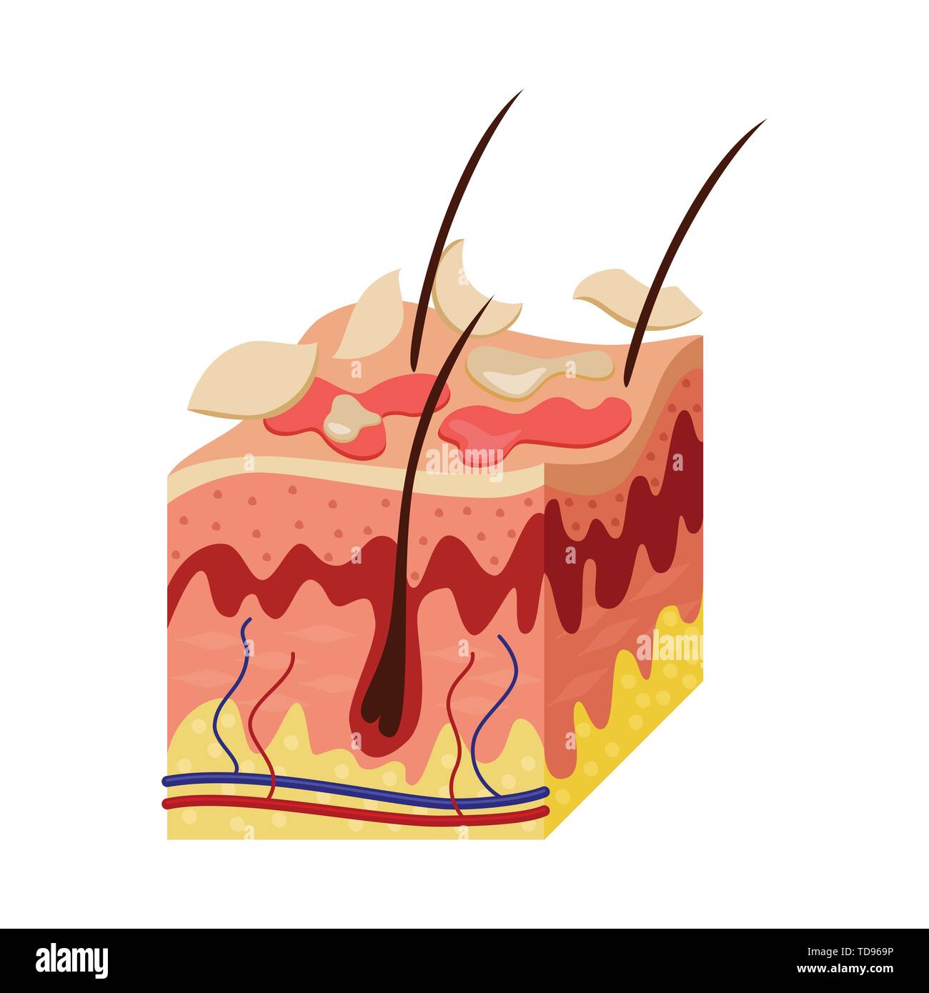 anatomy,pore,follicle,hair,gland,body,skin,epidermis,adipose,tissue ...
