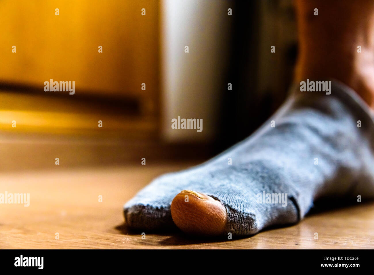 Broken sock with a hole in a man's big toe, concept of poverty during ...