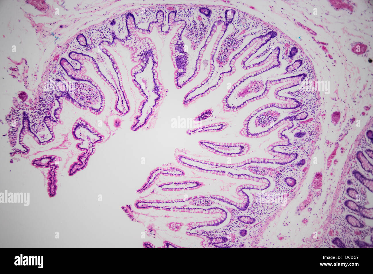 Small intestine cross section hi-res stock photography and images - Alamy