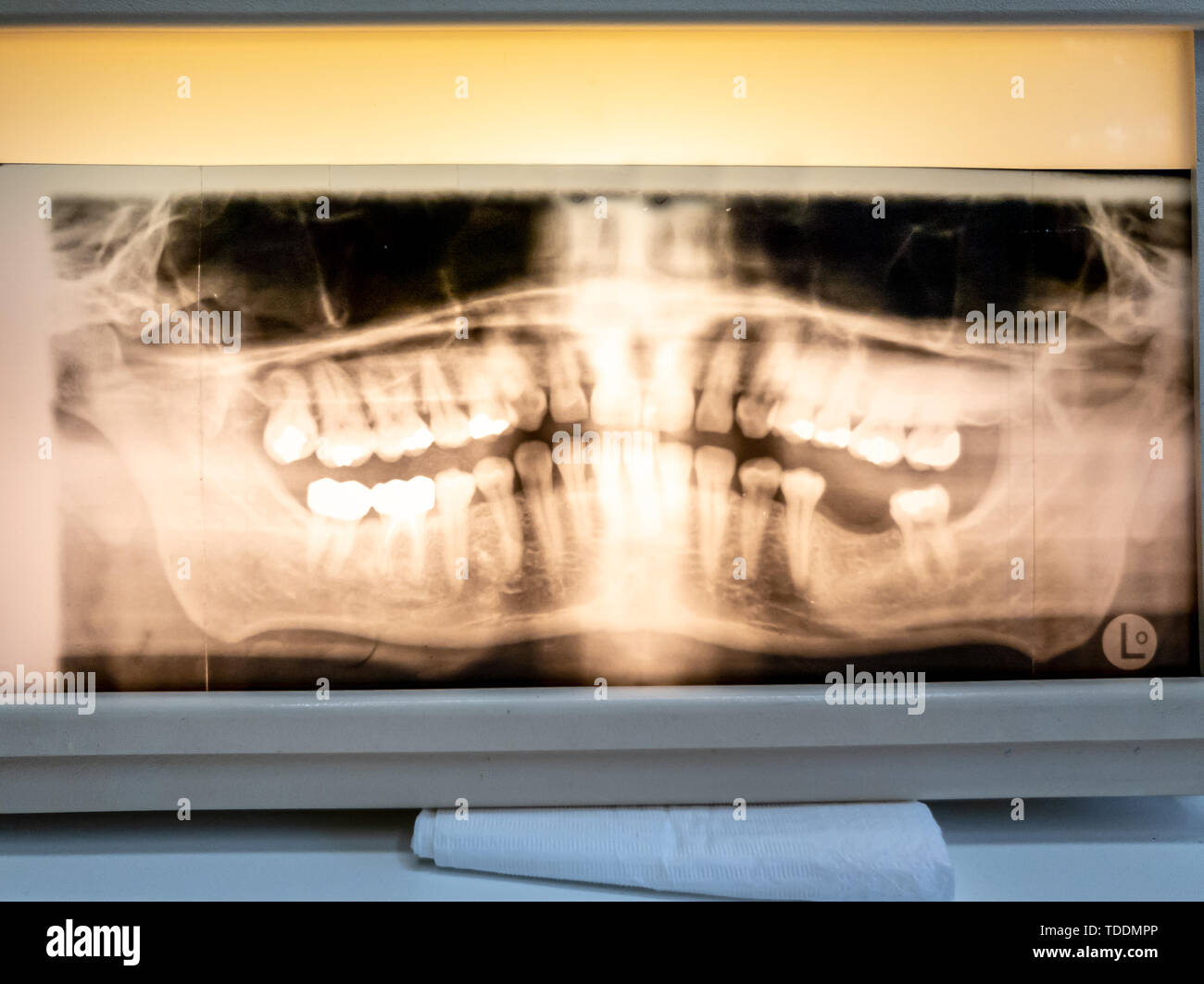 Missing screw hi-res stock photography and images - Alamy