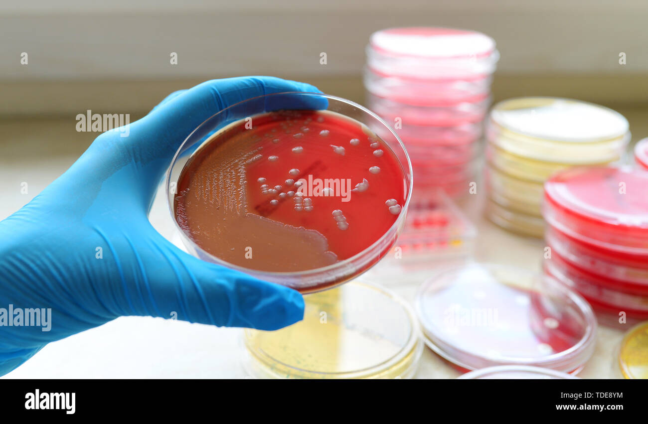 Medical clinic Pathological bacteria cultivation sample test Stock ...