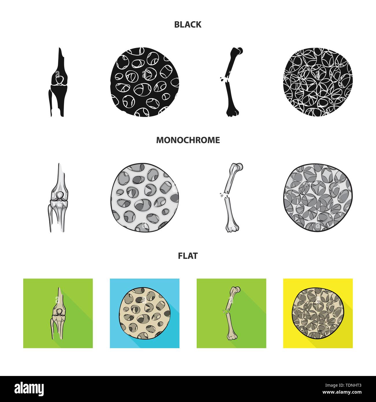 femur,fiber,fracture,osteoporosis,bony,healthy,pain,cell,leg,scientific ...