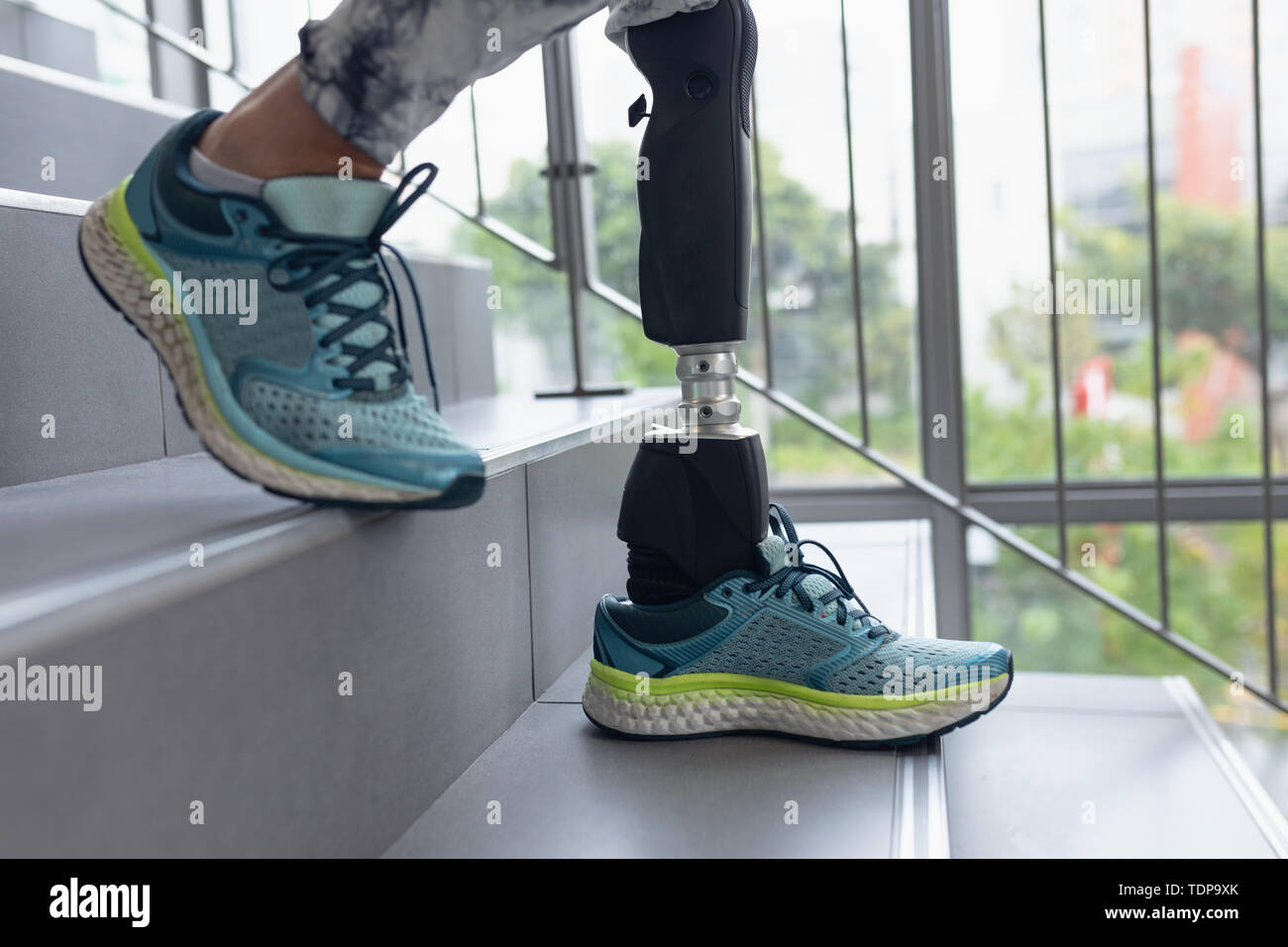 Disabled female patient with prosthetic leg walking on stairs in ...