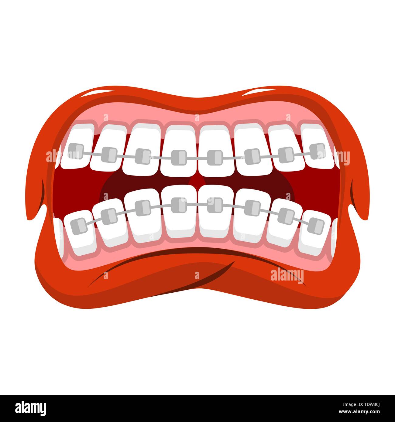 Braces on teeth. Open mouth and tooth Stock Vector Image & Art - Alamy