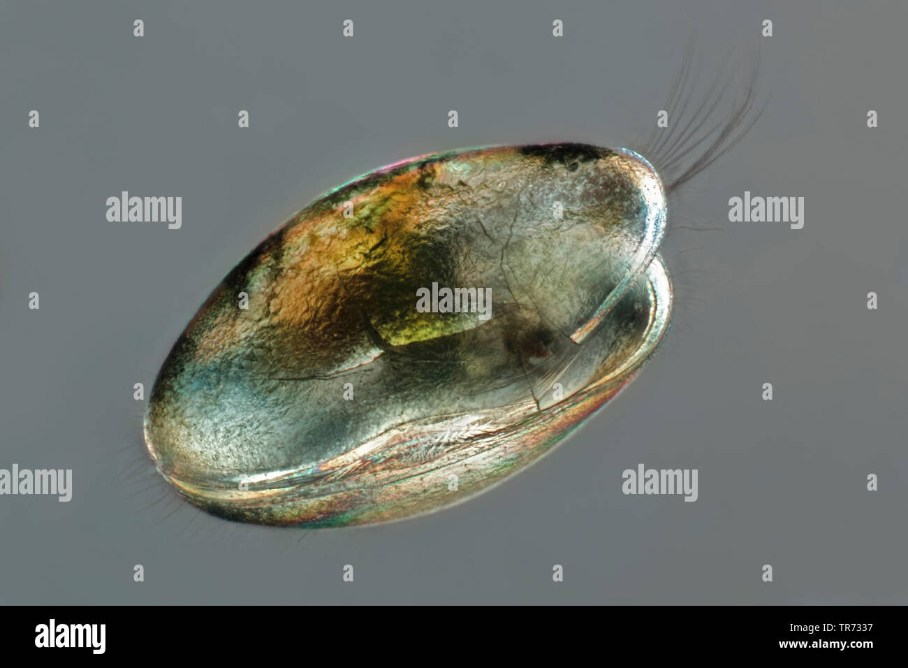 Seed Shrimp Under A Microscope