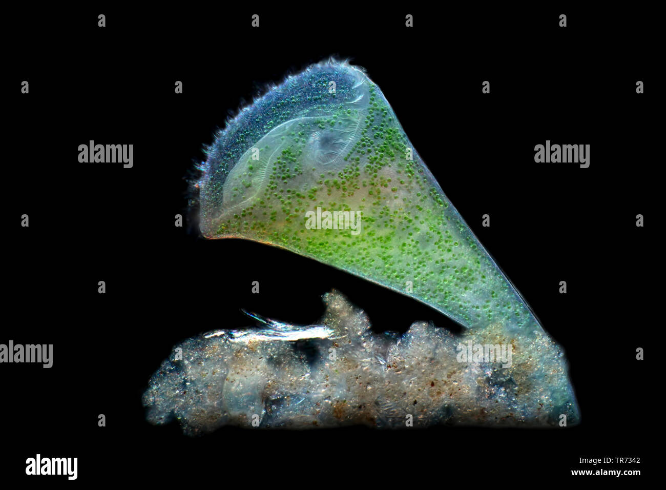 Stentor Under Microscope 40x