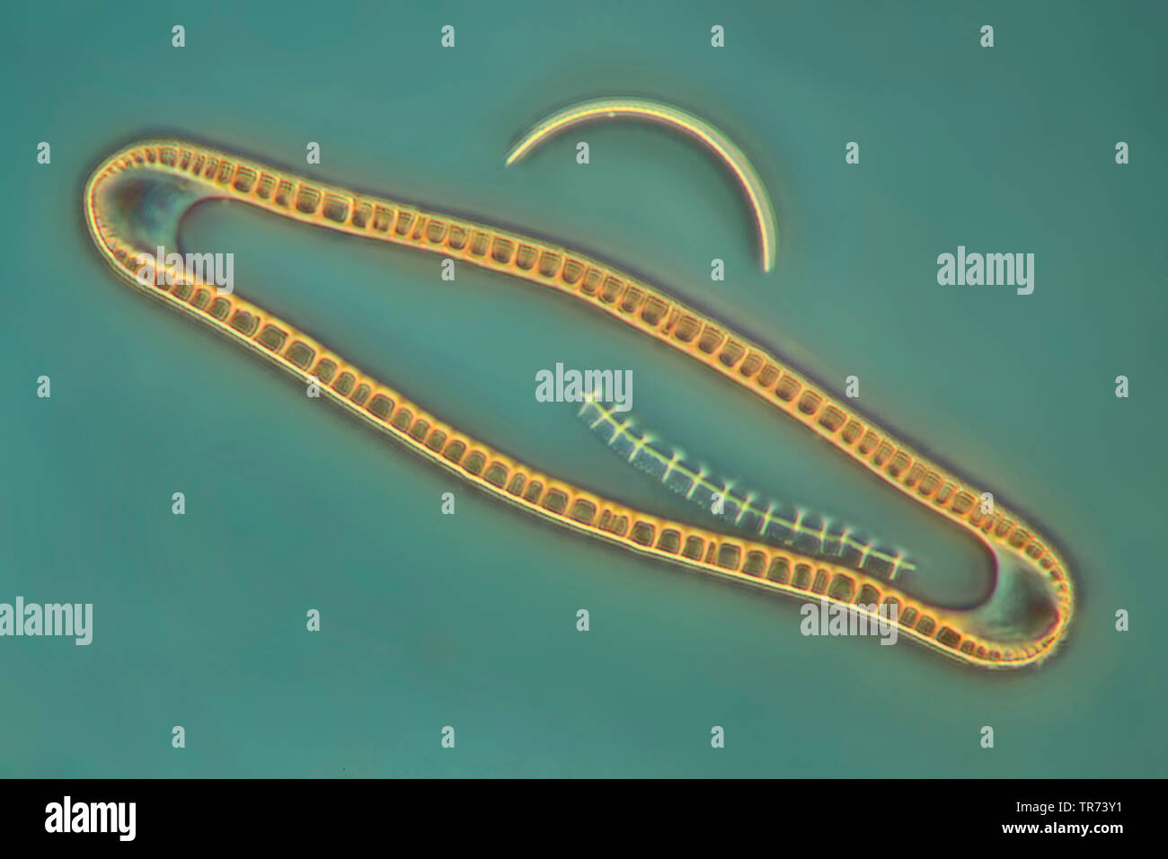 diatom (Diatomeae), diatom in phase contrast and interference contrast ...