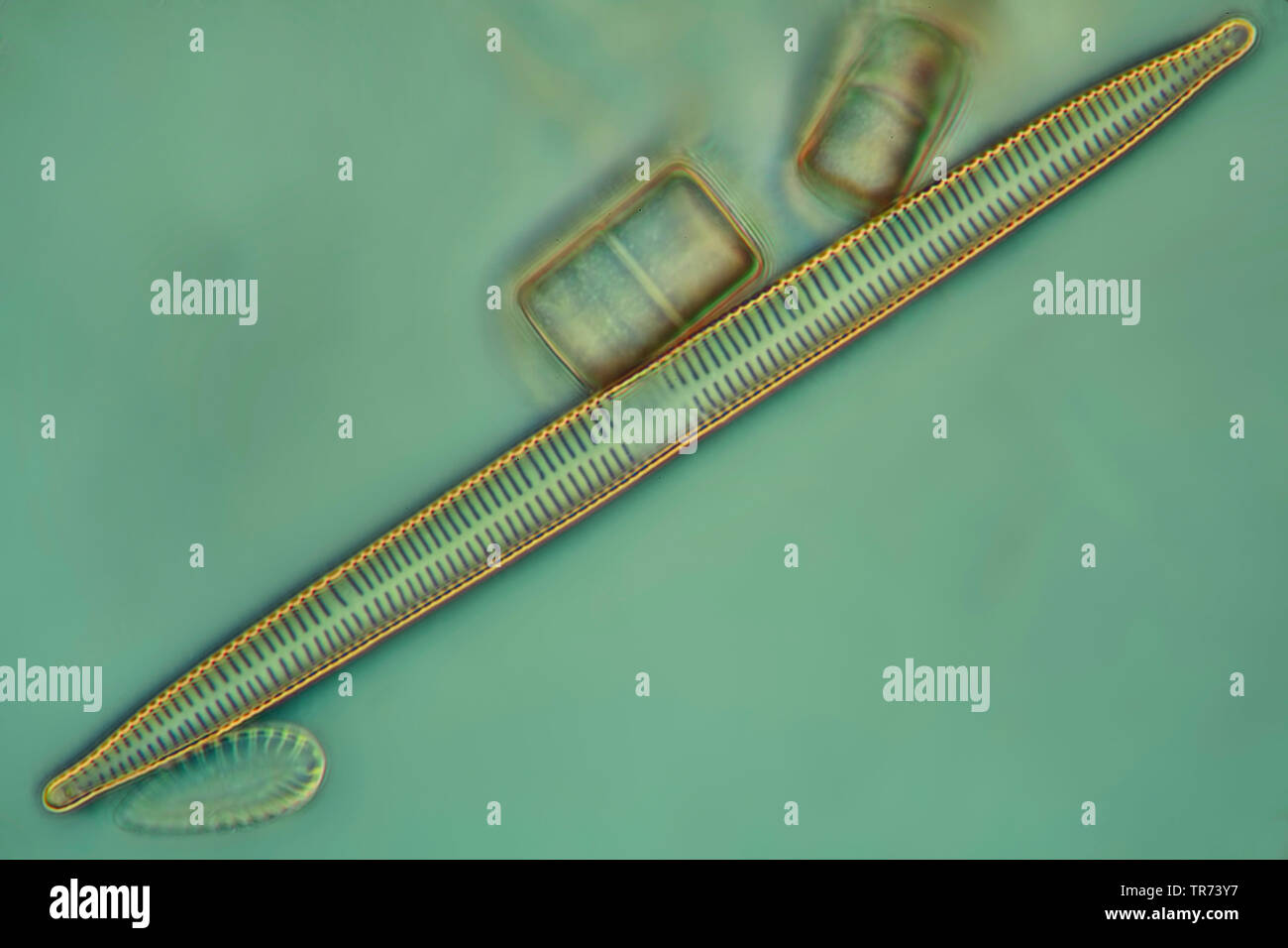 diatom (Diatomeae), diatoms in phase contrast and interference contrast ...