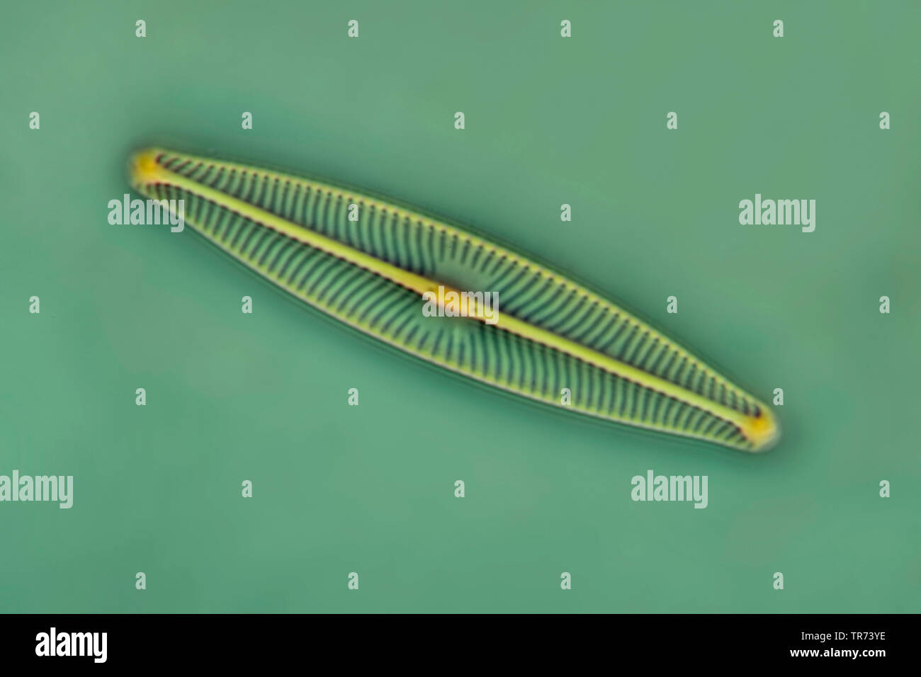 diatom (Diatomeae), diatom in phase contrast and interference contrast ...
