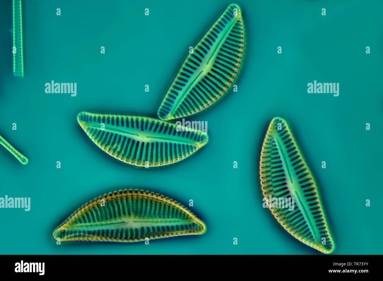 diatom (Diatomeae), diatoms in phase contrast and interference contrast ...