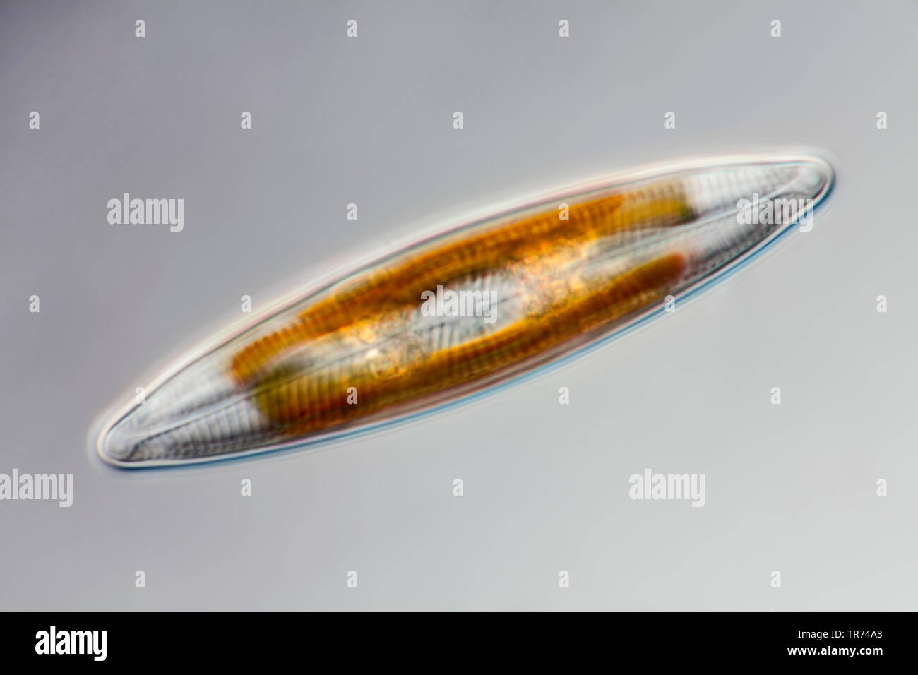 diatom (Diatomeae), living diatom from West Iceland, in differential ...
