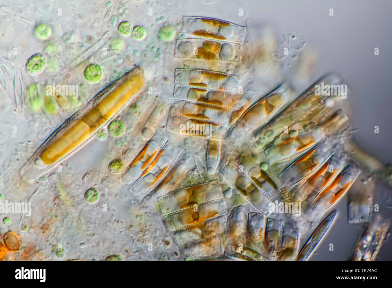 diatom (Diatomeae), living diatoms from West Iceland, in differential ...