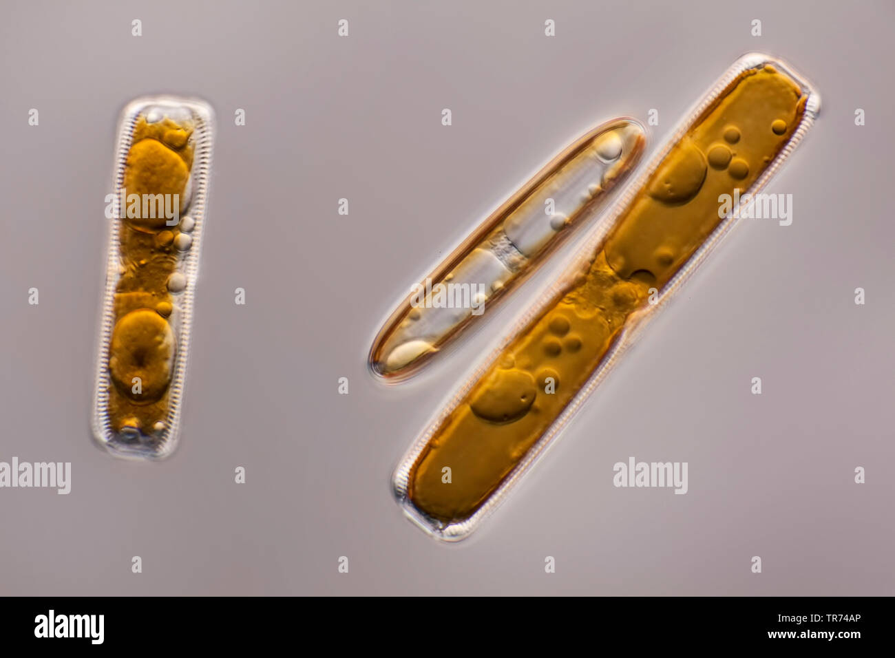 diatom (Diatomeae), living diatoms from Tessin, in differential ...