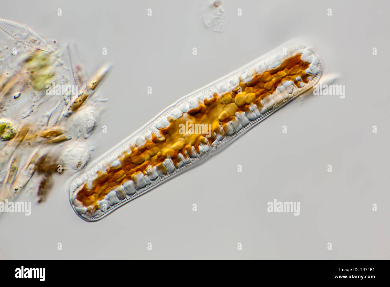 diatom (Diatomeae), living diatom from West Iceland, in differential ...