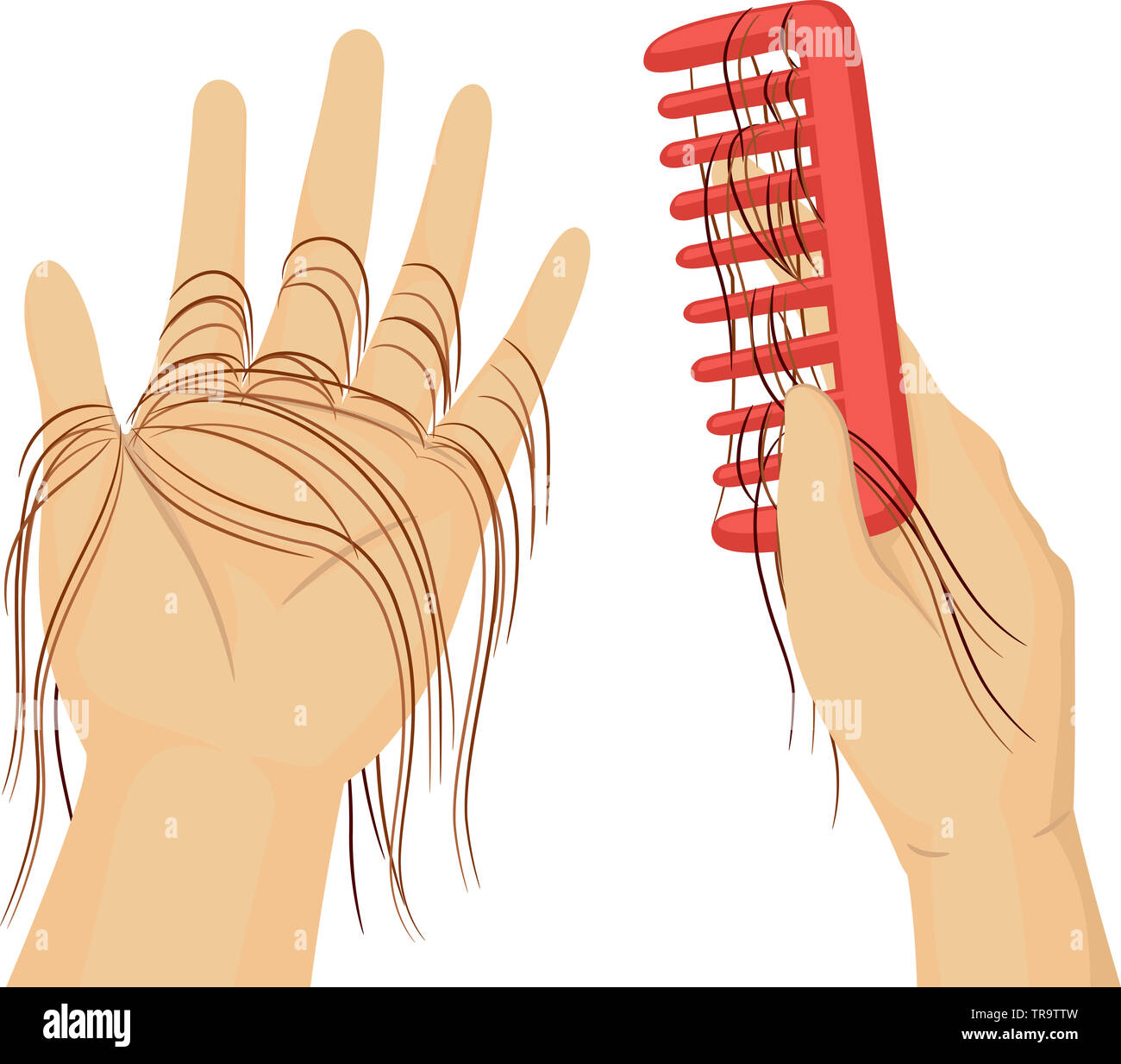 Illustration of Hands Holding Comb with Lots of Fallen Hair Stock Photo ...