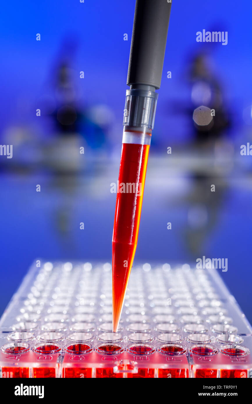 Medical research lab or Laboratory blood test testing samples of blood ...