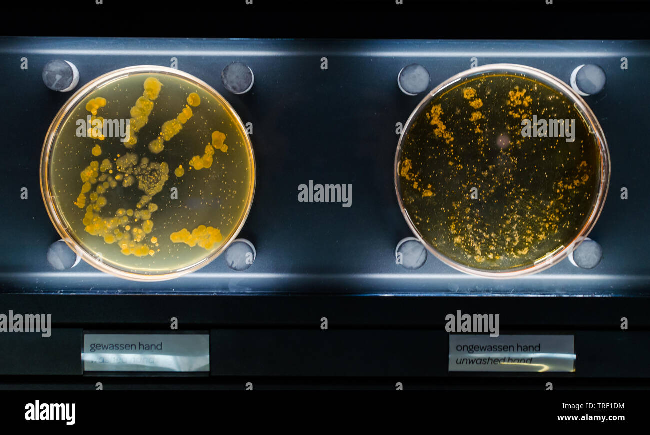 Unwashed and washed hand bacterias in petri dish Stock Photo - Alamy