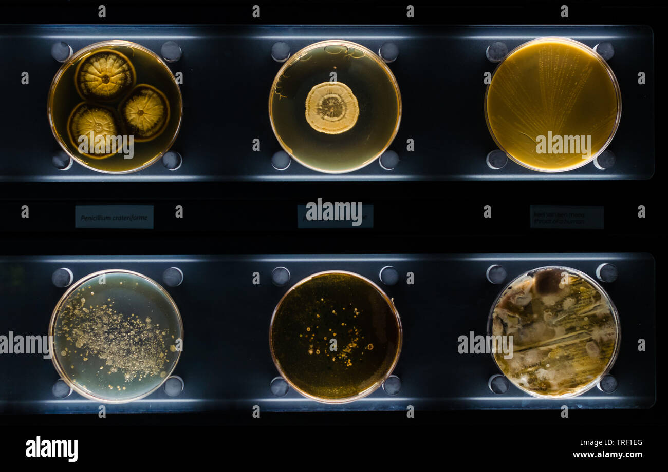 different samples with kinds of bacterias living at common household ...