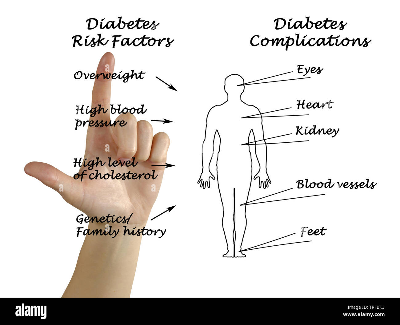 Diabetic cardiomyopathy Cut Out Stock Images & Pictures - Alamy