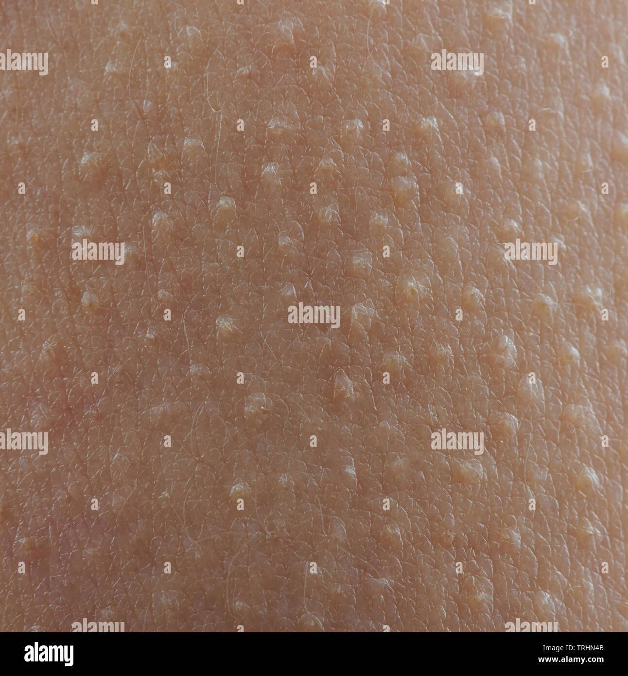 Goose bumps on brown skin close up macro view Stock Photo - Alamy
