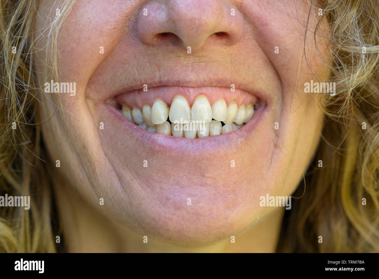 Close up detail on the lower face with smiling mouth and teeth of a ...